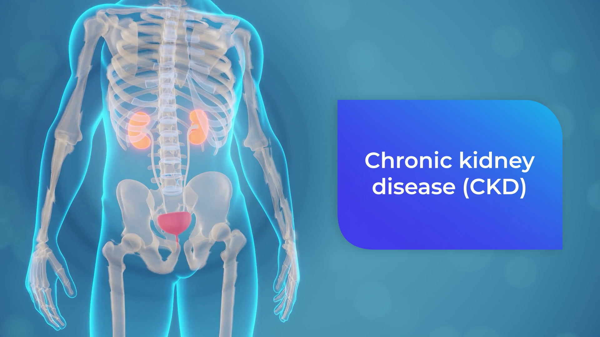 My Kidney Assistant - Cognitant